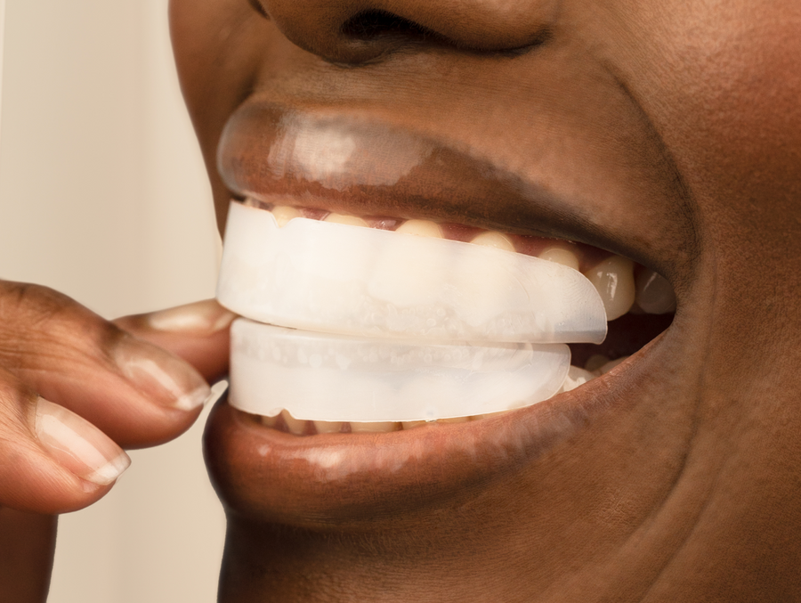 Prefilled Whitening Trays | BURST Oral Care
